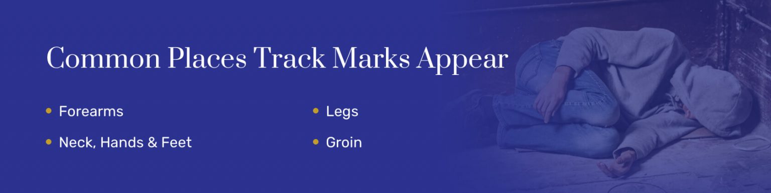 Heroin Track Marks | How to Tell if Someone Is Using Heroin?