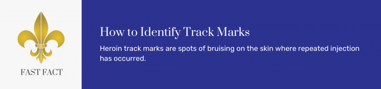 Heroin Track Marks | How to Tell if Someone Is Using Heroin?